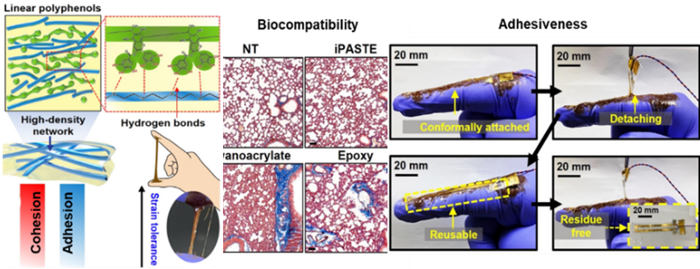 Neural Interfaces Team > Neuro Technology Group > Research > ibs